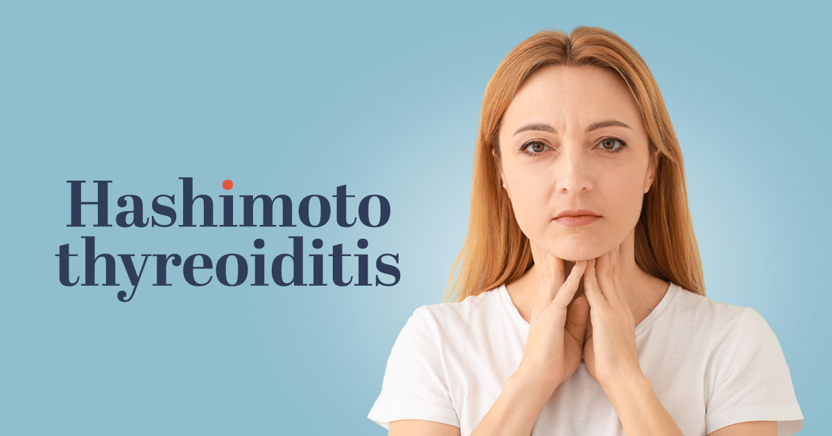 Hashimoto -thyreoiditis –információk, tünetek, kezelési lehetőségek